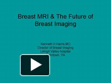 Breast MRI presentation | free to view