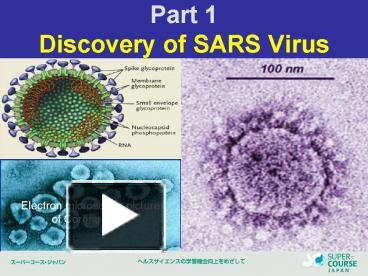 PPT – Part 1 Discovery of SARS Virus PowerPoint presentation | free to ...