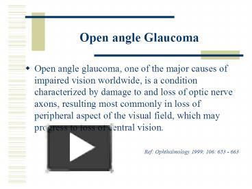 Open angle Glaucoma presentation | free to view