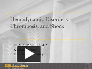 Hemodynamic Disorders, Thrombosis, and Shock presentation | free to view