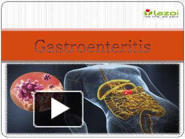gastroenteritis (1) presentation | free to download