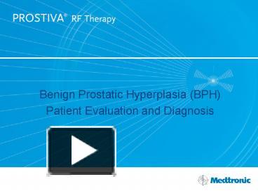 Benign Prostatic Hyperplasia (BPH) presentation | free to download