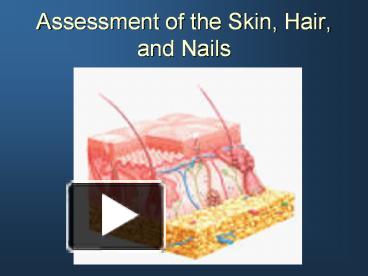 Assessment of the Skin, Hair, and Nails presentation | free to view