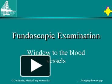 Fundoscopic Examination presentation | free to download