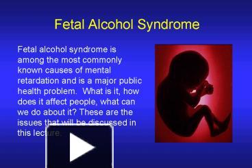 Fetal Alcohol Syndrome presentation | free to view