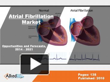 PPT – Atrial Fibrillation Device Market - Global Industry Analysis ...