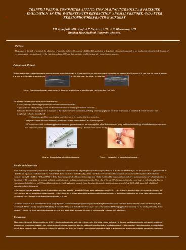 TRANSPALPEBRAL TONOMETER APPLICATION DURING INTRAOCULAR PRESSURE ...