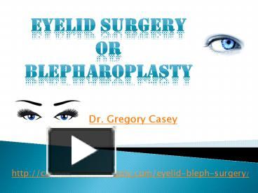 PPT – Dr. Gregory Casey Explains Eyelid Surgery PowerPoint presentation ...