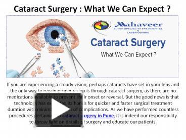 PPT – Cataract Surgery : What We Can Expect ? PowerPoint presentation ...