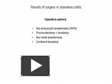 PPT – Operative options PowerPoint presentation | free to view - id ...