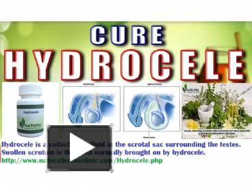 Herbal Remedies for Hydrocele presentation | free to download