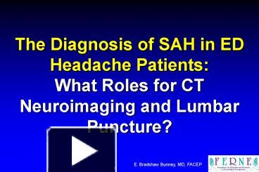 PPT – The Diagnosis of SAH in ED Headache Patients: What Roles for CT ...