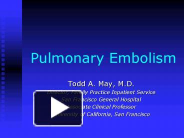 Pulmonary Embolism presentation | free to view