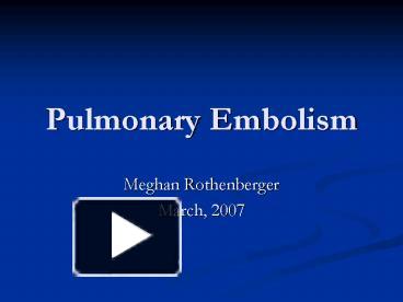 Pulmonary Embolism presentation | free to view