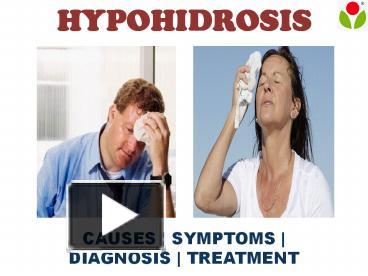 Hypohidrosis: Causes, sign, symptoms, diagnosis and treatment ...
