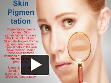 Skin Pigmentation presentation | free to download