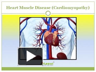 PPT – Heart Muscle Disease (Cardiomyopathy) PowerPoint presentation ...