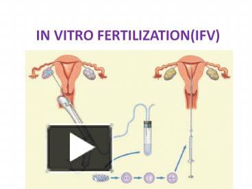 modified natural cycle ivf protocol presentation | free to download