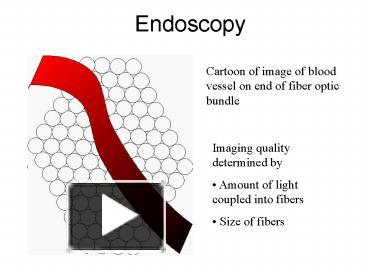 PPT – Endoscopy PowerPoint presentation | free to view - id: 8763a-ZDc1Z
