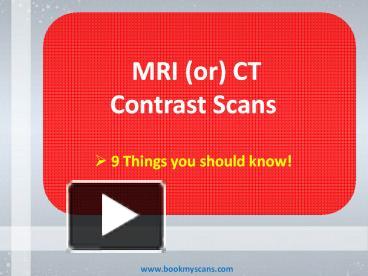 PPT – 9 Things you should know! Contrast Scans - MRI (or) CT PowerPoint ...