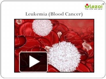 Leukemia (Blood Cancer) presentation | free to download