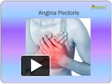 Angina Pectoris: Risk factors, Symptoms, Diagnosis and Treatment ...