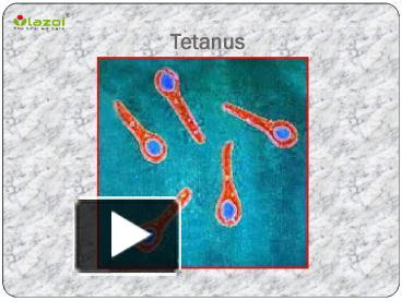 Tetanus : causes, symptoms, types, diagnosis, treatment and prevention ...