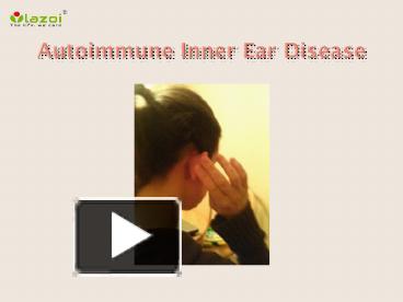 Autoimmune Inner Ear Disease: Symptoms, treatment and prevention ...
