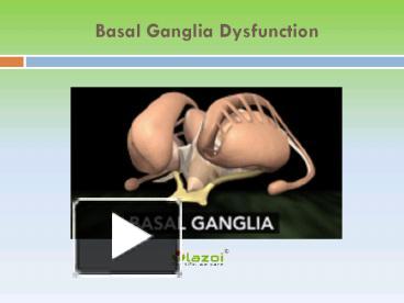 PPT – Basal ganglia dysfunction: What you need to know PowerPoint ...