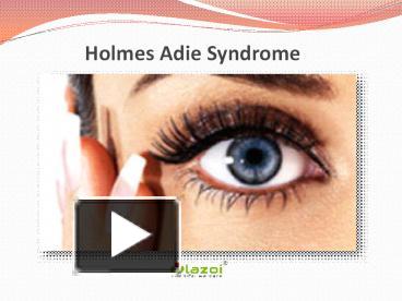 Holmes-Adie Syndrome (Adie’s Pupil): An overview of symptoms, causes ...