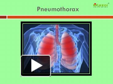 PPT – Pneumothorax: Symptoms, causes, diagnoses and treatment ...