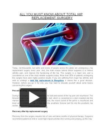 PPT – All You Must Know About Total Hip Replacement Surgery PowerPoint ...