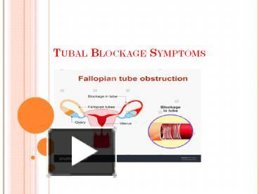 Tubal Blockage Symptoms 10 oct 17 presentation | free to download