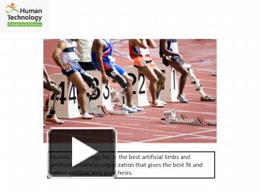 PPT – Prosthetic Limb Companies PowerPoint presentation | free to ...