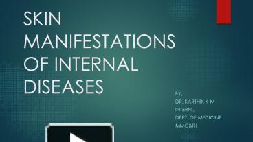 SKIN MANIFESTATIONS OF INTERNAL DISEASES presentation | free to download