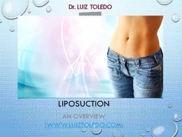 PPT – Liposuction Dubai PowerPoint presentation | free to download - id ...