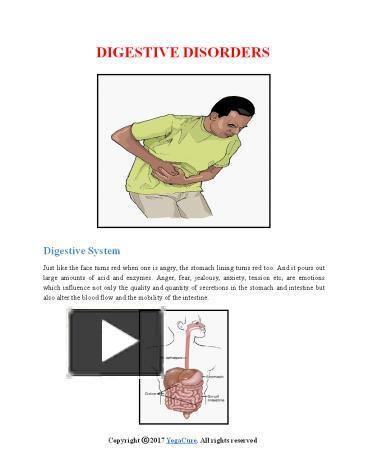 PPT – Digestive Disorders (1) PowerPoint presentation | free to ...