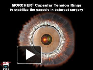 PPT – MORCHER PowerPoint presentation | free to view - id: 88f82-ZDc1Z