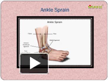 Ankle Sprain : Causes, Symptoms, complications, risk factor, treatment ...