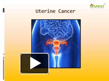 PPT – Uterine Cancer: Causes, Symptoms, risk factor, diagnosis and ...