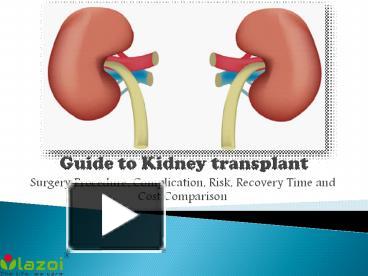Guide to Kidney transplant - Surgery Procedure, Complication, Risk ...