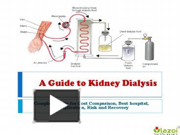 PPT – A guide to Kidney Dialysis PowerPoint presentation | free to ...