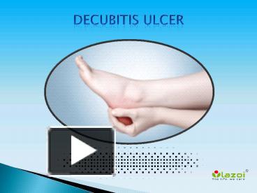 Decubitis Ulcer: Symptoms, Causes, Risk factors, Diagnosis, Treatment ...