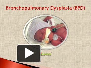 Bronchopulmonary dysplasia (BPD) in infants (1) presentation | free to ...