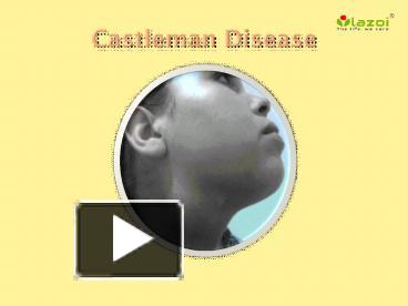 Castleman Disease: An overview of symptoms, diagnoses and treatment (1 ...