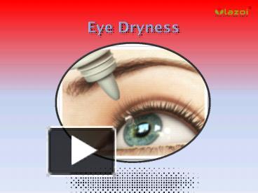 PPT – Dry eye syndrome (Eye Dryness): Symptoms, causes and treatment (1 ...