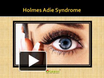 PPT – Holmes-Adie Syndrome (Adie’s Pupil): An overview of symptoms ...