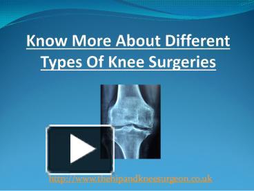 Know More About Different Types Of Knee Surgeries presentation | free ...