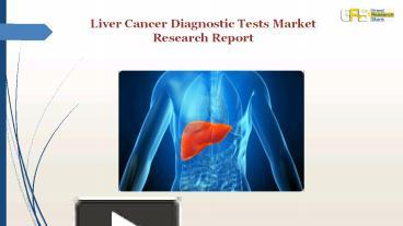 PPT – Liver Cancer Diagnostic Tests Market Research Report PowerPoint ...