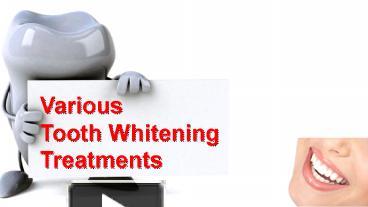 PPT – Various Tooth Whitening Treatments PowerPoint presentation | free ...